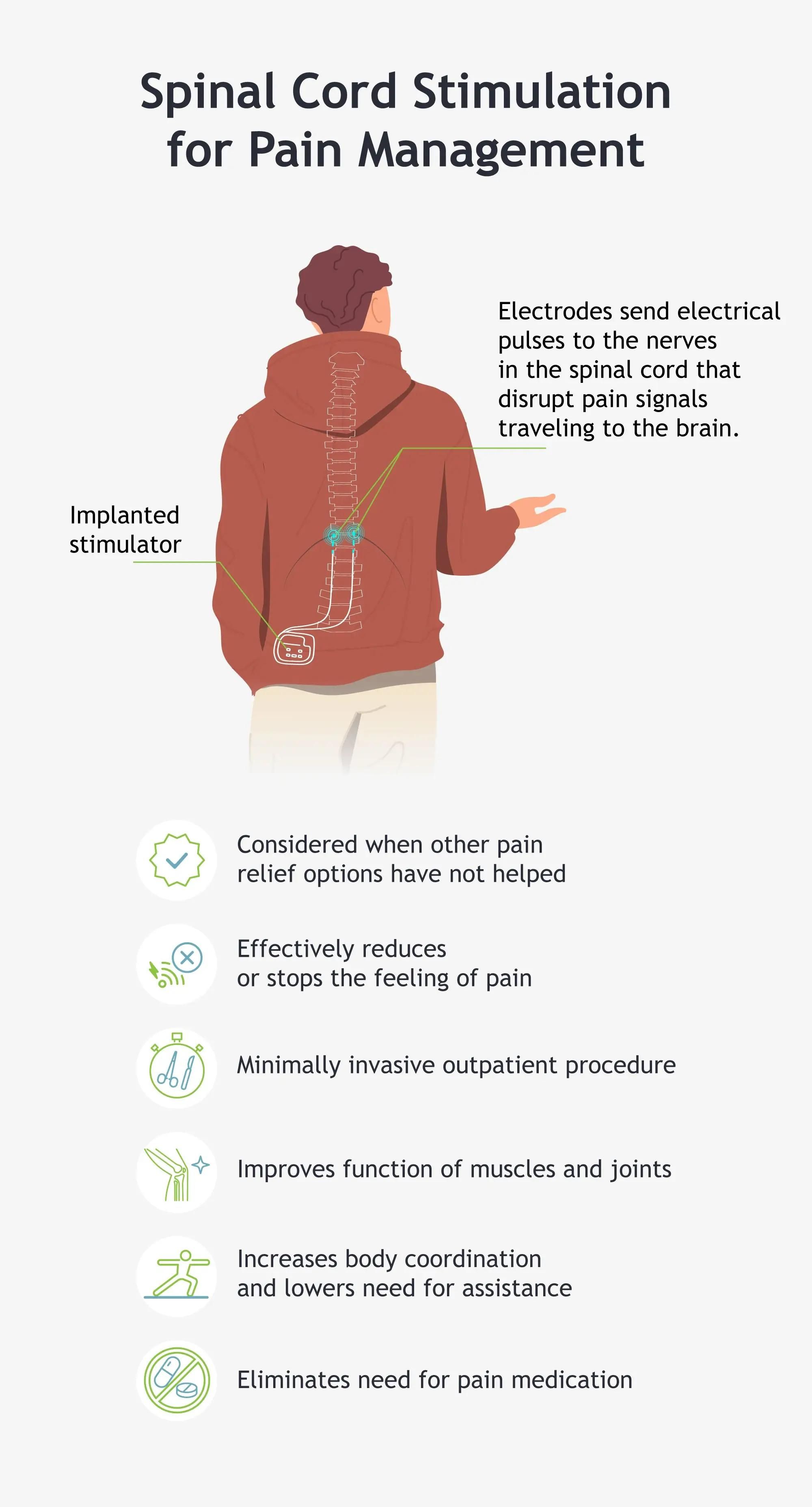 Spinal Cord Stimulation (SCS) | Advanced Spine and Pain
